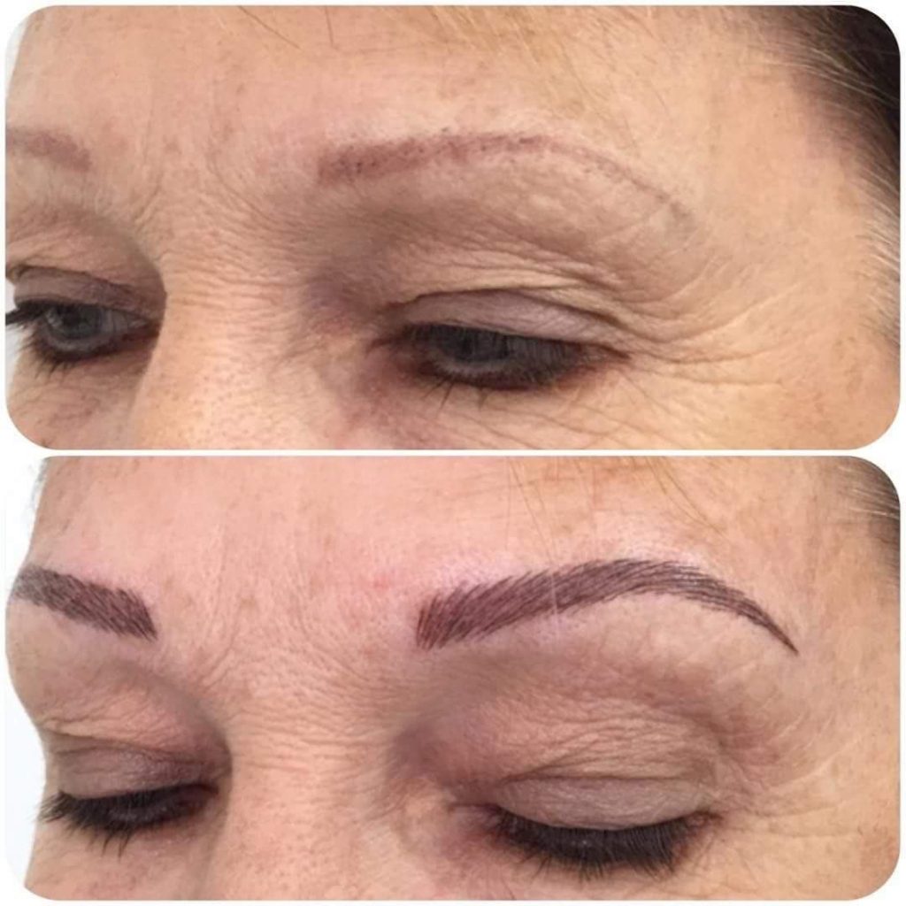 Permanent Eyebrow Transplant in Pune | Eyebrow Shaping in Pune